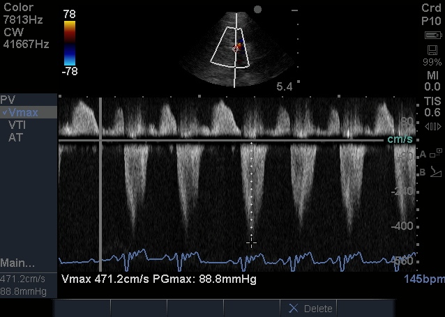 Cardiac – Canine – NVi – North East Veterinary Imaging